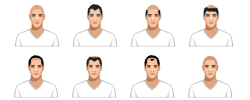 KAMIIRUのオーダーウィッグやカツラの納品までの流れ