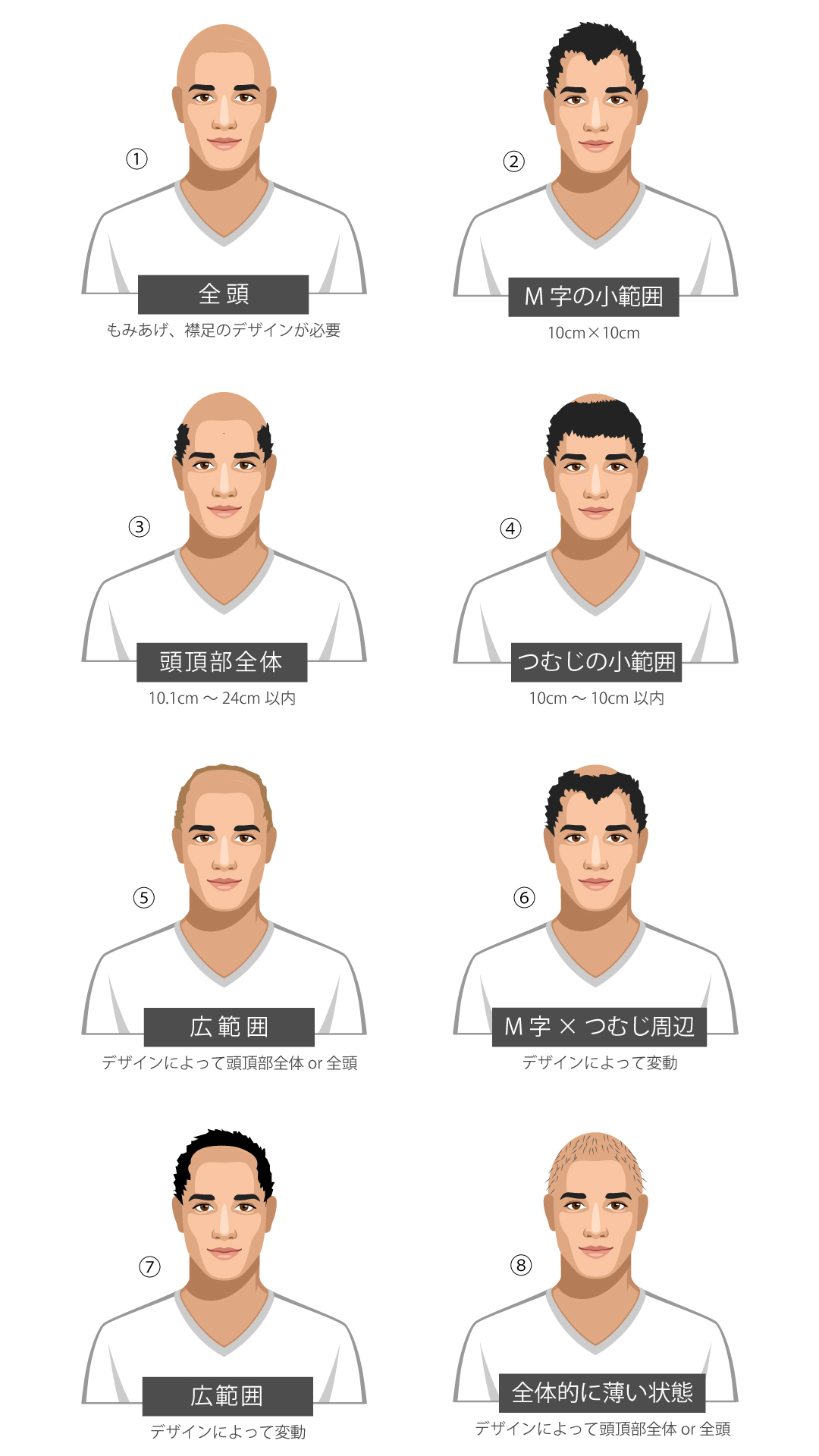 KAMIIRUの泳げるウィッグ・カツラの紹介